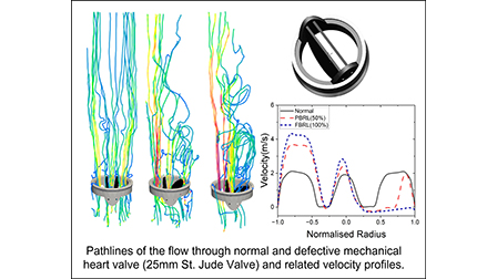 Fluid–structure interaction modeling of bi-leaflet mechanical heart valves using smoothed ...