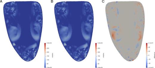 The triple decomposition of the velocity gradient tensor as a ...