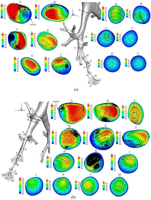 Large eddy simulation study of the airflow characteristics in a human ...