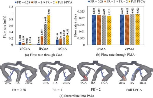 Assessing the impact of fetal-type posterior cerebral artery variations ...