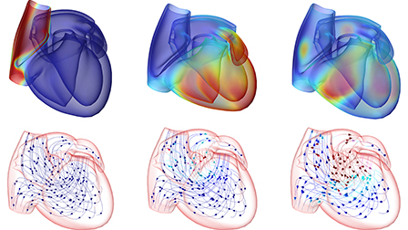 Numerical simulation progress of whole-heart modeling: A review ...