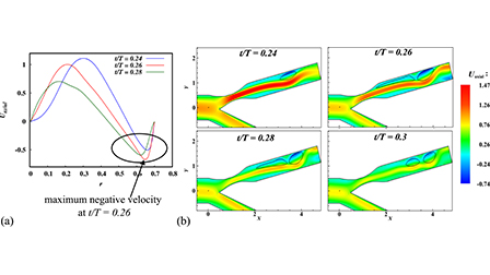 Computational hemodynamics and hemoacoustic study on carotid bifurcation: Effect of stenosis and ...