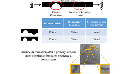 Hemodynamic coupling between a primary atherosclerotic plaque and ...