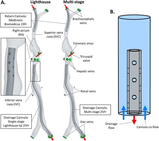 Venovenous extracorporeal membrane oxygenation drainage cannula ...