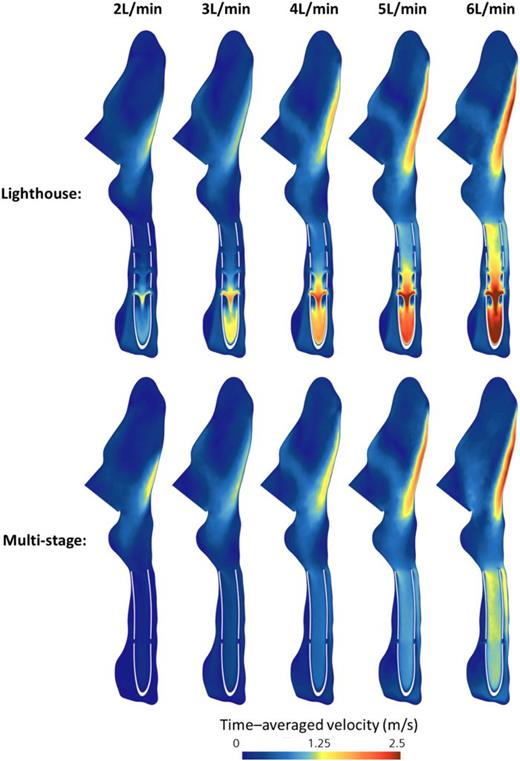 Venovenous extracorporeal membrane oxygenation drainage cannula ...