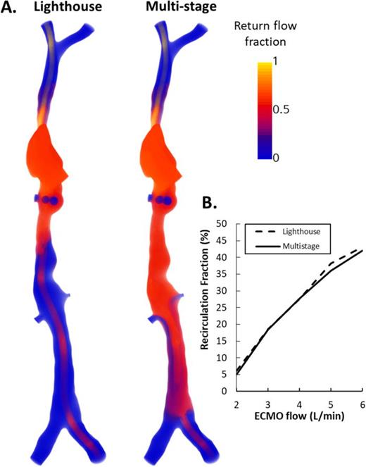 Venovenous extracorporeal membrane oxygenation drainage cannula ...
