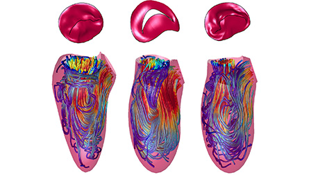 Modeling the fluid dynamics of mitral valve for clinical applications ...