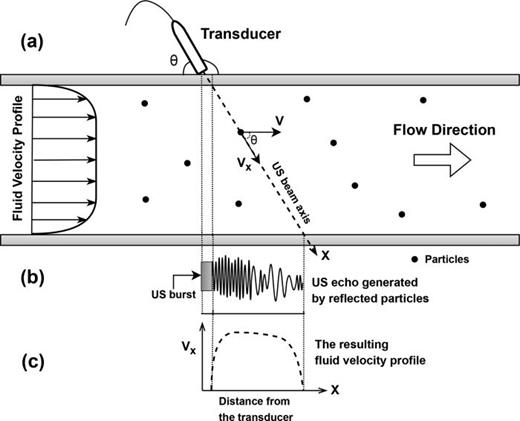 Advances in modeling the flow of Herschel–Bulkley fluids in pipes: A ...