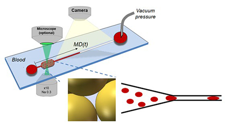 Ultrasensitive microfluidic detection of red blood cell deformability ...