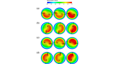 Effects of coiling index and vessel diameter on umbilical artery flow ...