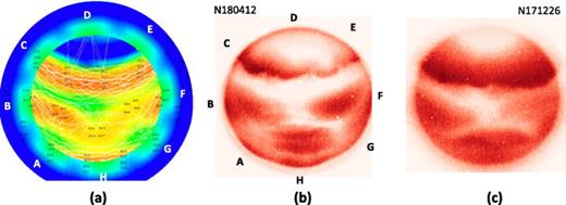 Understanding ICF hohlraums using NIF gated laser-entrance-hole images ...