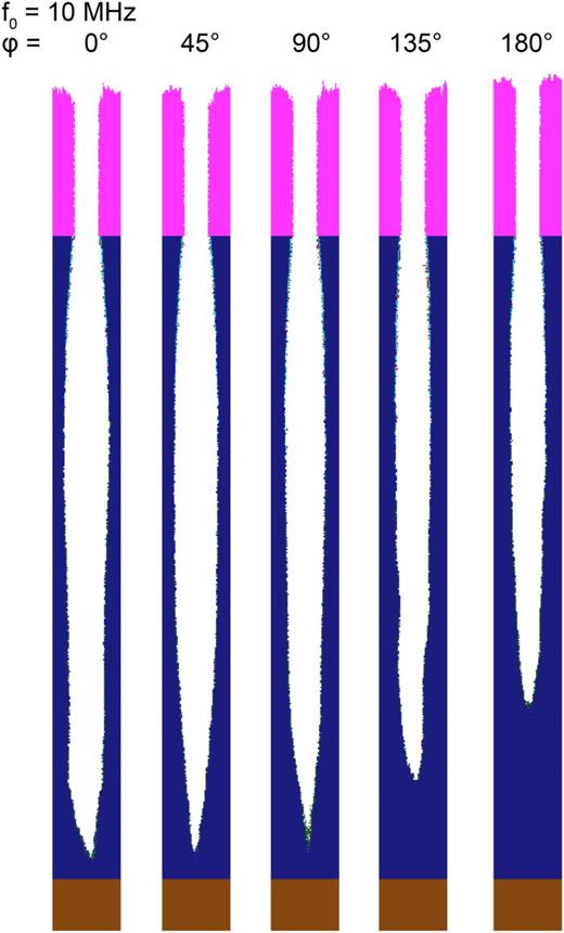 Voltage waveform tailoring for high aspect ratio plasma etching of SiO2 using Ar/CF4/O2 mixtures ...