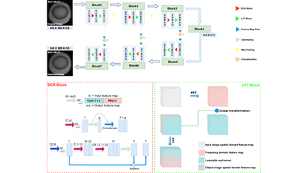 Multi-level noise reduction for 2D backlighting x-ray radiography using Frequency Residual U-Net ...