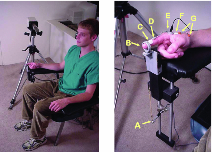 Laser Doppler vibrometry measurement of the mechanical myogram | Review ...