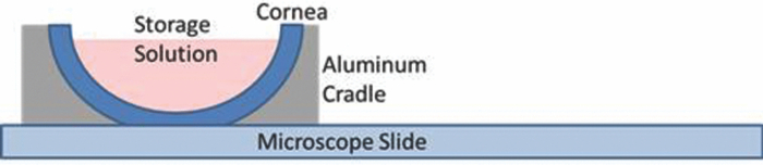 Assessing the phase retardation in corneal tissues using a femtosecond ...