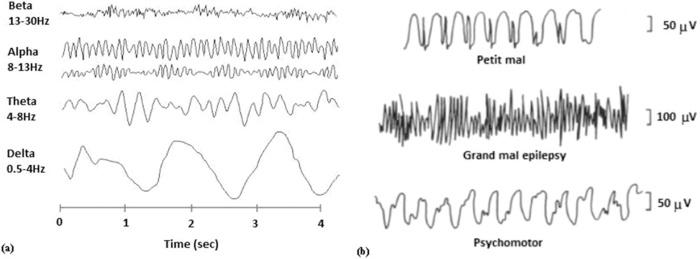 Brain Source Localization A New Method Based On Multiple Signal