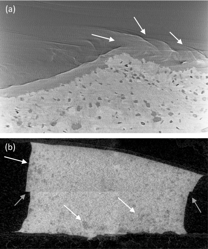 Prevention of cartilage dehydration in imaging studies with a ...