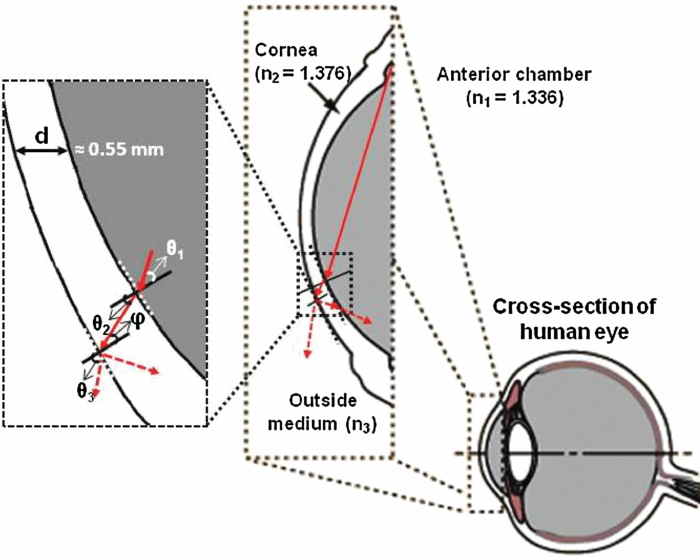 Note: A gel based imaging technique of the iridocorneal angle for ...