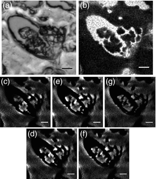 Laboratory-size three-dimensional x-ray microscope with Wolter type I ...