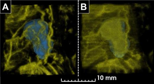A new preclinical ultrasound platform for widefield 3D imaging of ...