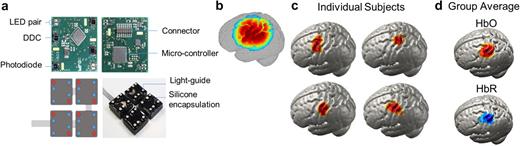 High-density diffuse optical tomography for imaging human brain ...
