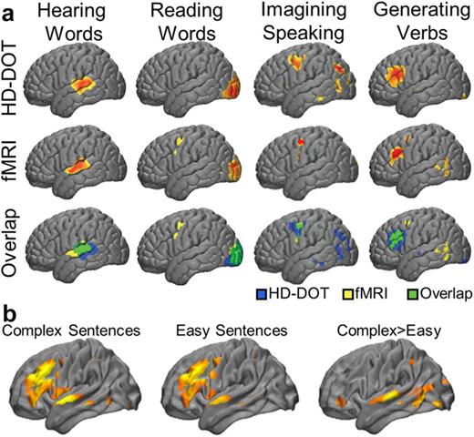 High-density diffuse optical tomography for imaging human brain ...