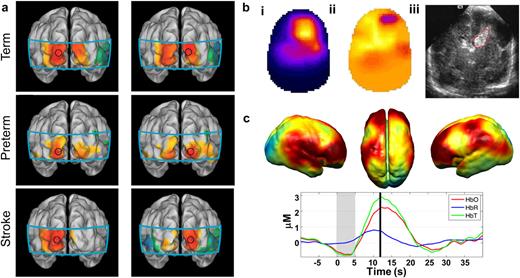 High-density diffuse optical tomography for imaging human brain ...