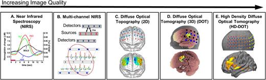 High-density diffuse optical tomography for imaging human brain ...