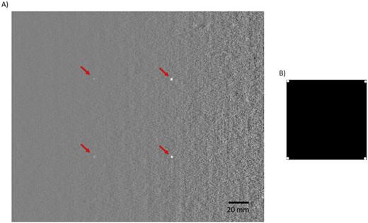 Implementation of a point spread function method to analyze flash ...