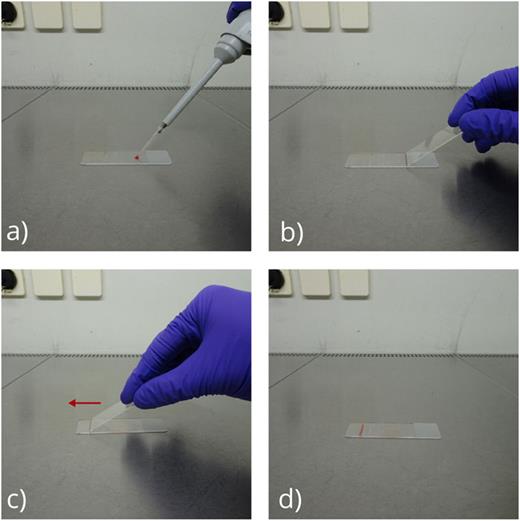 autohaem: 3D printed devices for automated preparation of blood smears ...
