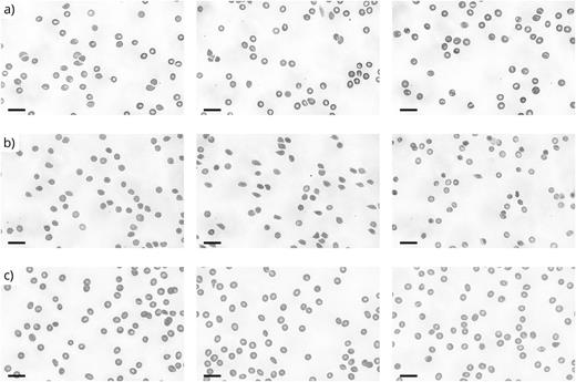 autohaem: 3D printed devices for automated preparation of blood smears ...