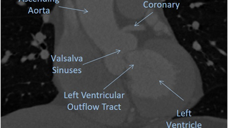Segmentation of human aorta using 3D nnU-net-oriented deep learning | Review of Scientific ...