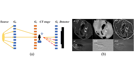 A multimodal image feature extraction method for x-ray grating phase ...