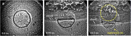 Invited article: X-ray phase contrast imaging in inertial confinement ...