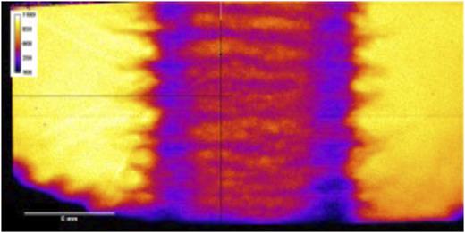 Hybrid CMOS detectors for high-speed X-ray imaging | Review of ...