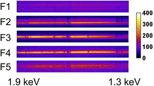 Hybrid CMOS detectors for high-speed X-ray imaging | Review of ...