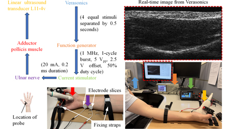 Quantitative neuromuscular monitoring with train-of-four ratio using ...