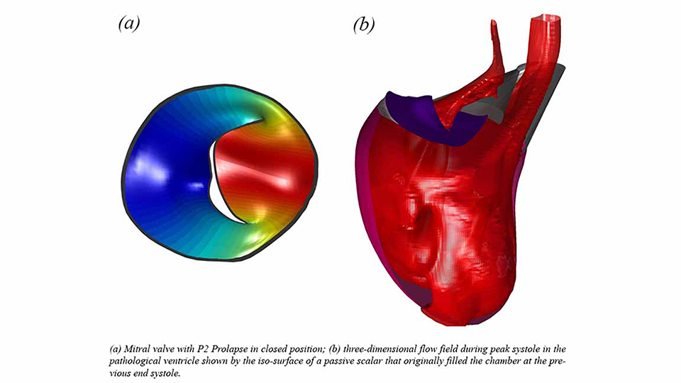 Simplified model of mitral valve regurgitations provides insight on ...