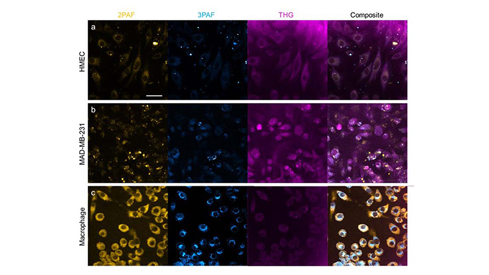 Label-free multiphoton microscopy promises real-time optical molecular ...