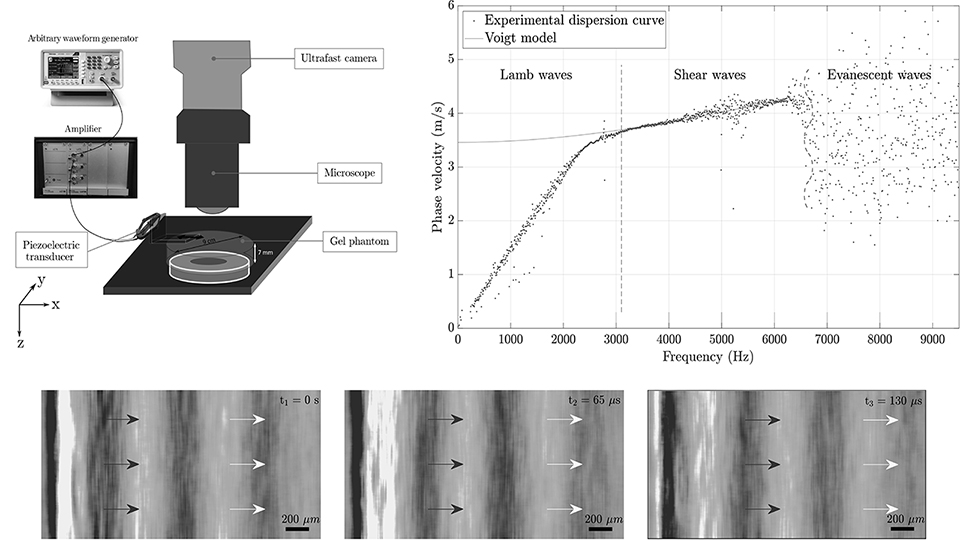 Ultrasonic shear wave propagation in soft tissues for microelastography | Scilight | AIP Publishing