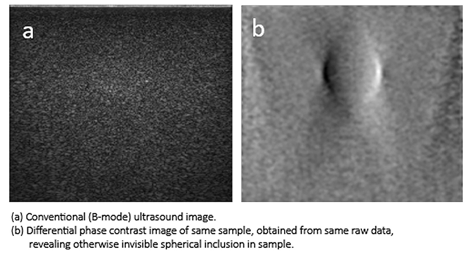 Aberrations in ultrasound images are not just noise | Scilight | AIP Publishing