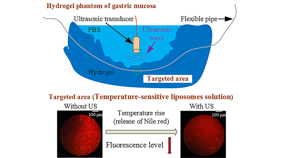 Temperature-sensitive liposomes employ ultrasound for chemotherapy use | Scilight | AIP Publishing