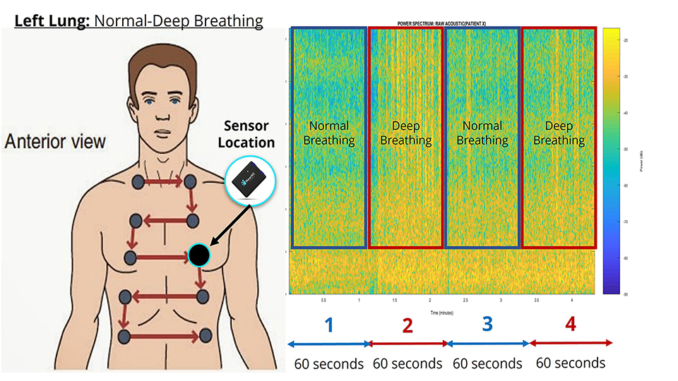 Wearable sensor system tracks lung function for COPD patients ...