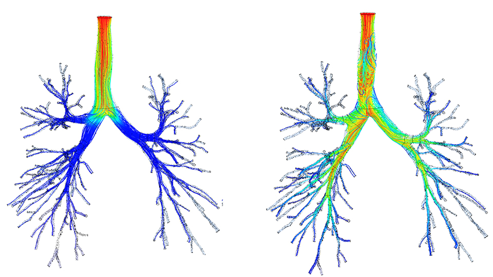 Computational fluid dynamics used to model heat transfer within lungs ...
