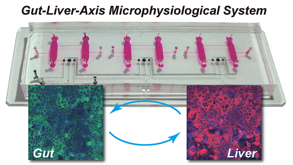 Enhancing realism of gut-liver axis model | Scilight | AIP Publishing
