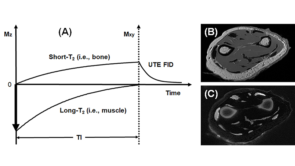 Imaging invisible tissues with Ultrashort Echo Time magnetic resonance ...