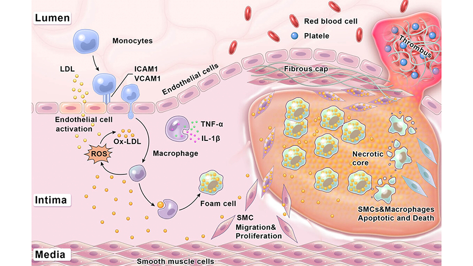 Advances in nanomedicine hold promise for diagnosis and treatment of ...
