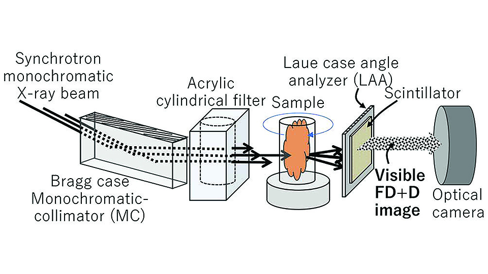 High-resolution phase-contrast X-ray imaging for biological soft tissue ...