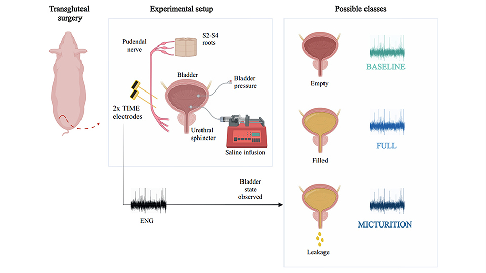 Streamlining neural signal detection for improved bladder control prostheses | Scilight | AIP ...