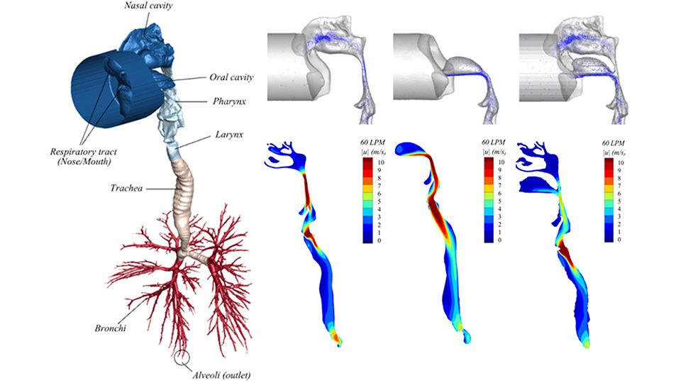 Simulating aerosol transmission using realistic anatomical models of ...